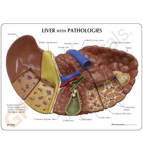 Liver Anatomical Model Normal and Pathologies